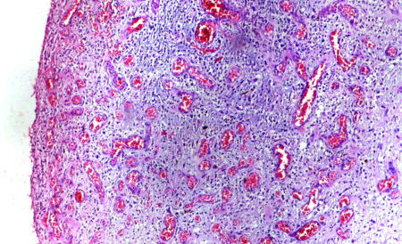 Inflammatory Conditions | NatureMed Clinic